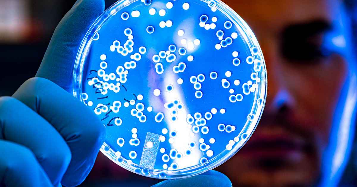 Drug-resistant fungus is on the rise worldwide - Universiteit van Amsterdam