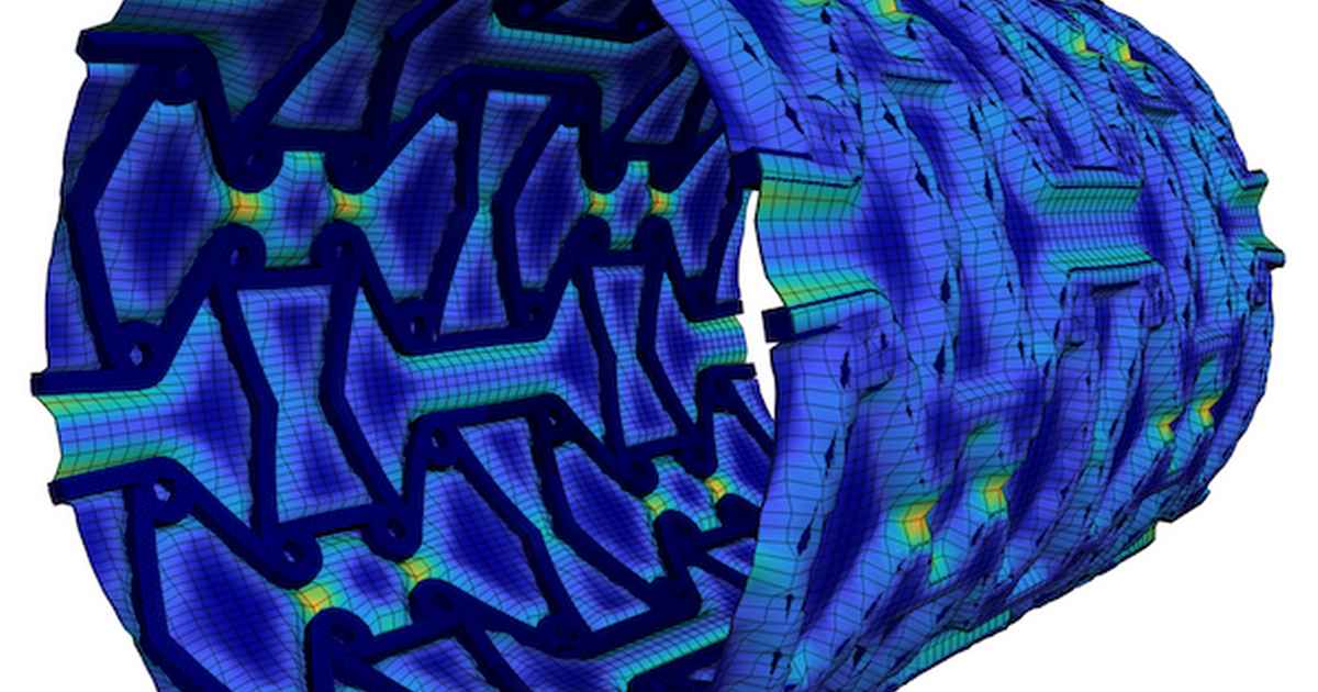 EXPAND - Enabling growth-adaptive eXpansion of vascular grafts with ...